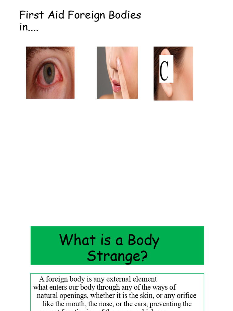6 STRANGE BODIES EYE-NOSE-EAR - Yes | PDF | Human Nose | Medical ...