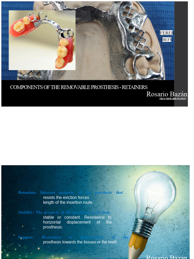 Removable Prosthesis Retainers Explained | PDF | Dentistry | Dentistry ...