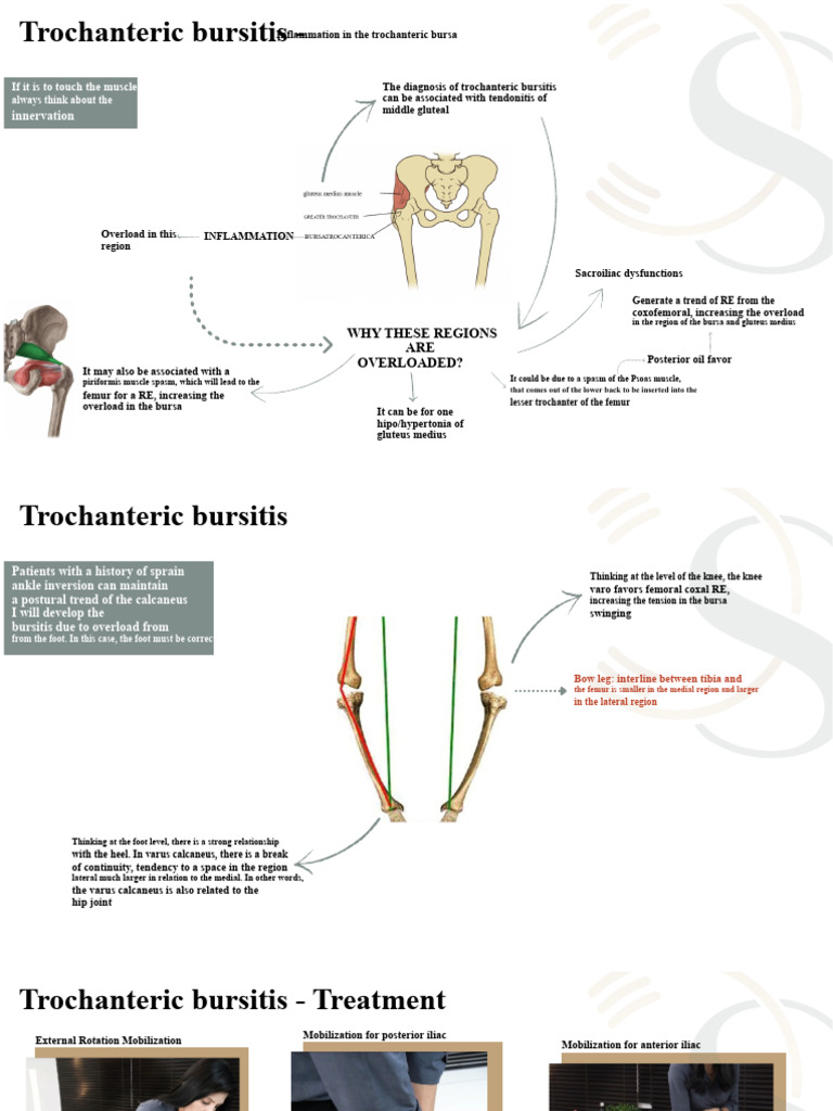 Mind map - Trochanteric Bursitis | PDF | Knee | Human Anatomy