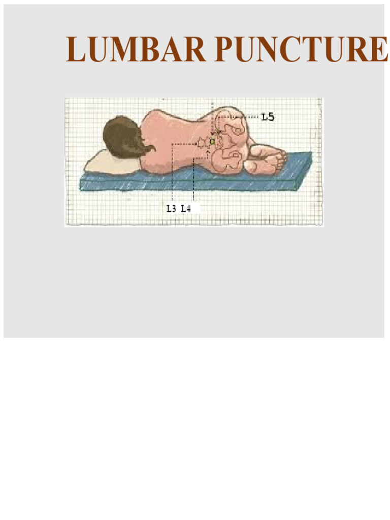 243885487-LUMBAR-PUNCTURE-EXPO-ppt | PDF | Cerebrospinal Fluid ...