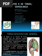 Radiografía de Tórax Normal - Patrón Intersticial | PDF | Pulmón | Tórax