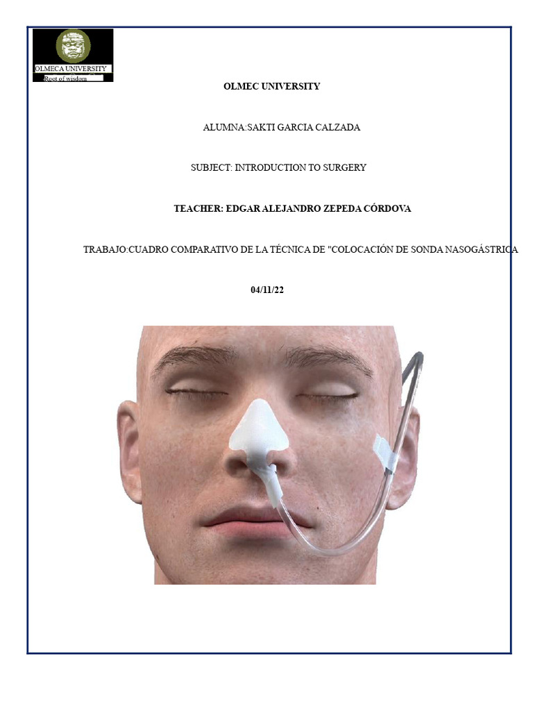 COMPARATIVE CHART OF NASOGASTRIC TUBE PLACEMENT | PDF | Medical ...