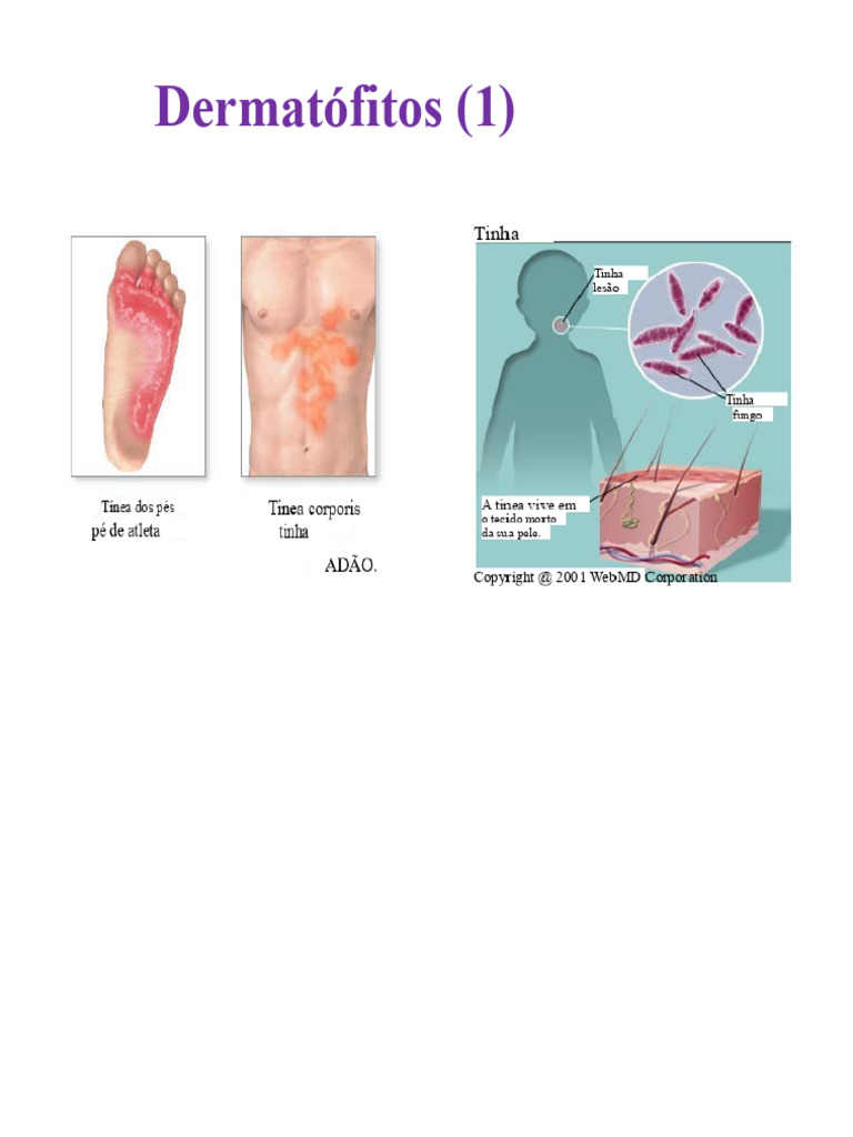 Entendendo os Dermatófitos e suas Infecções | PDF | Fungo | Bactérias