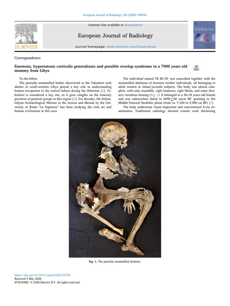 Ancient Mummy's Sclerosing Bone Dysplasia | PDF | Musculoskeletal ...