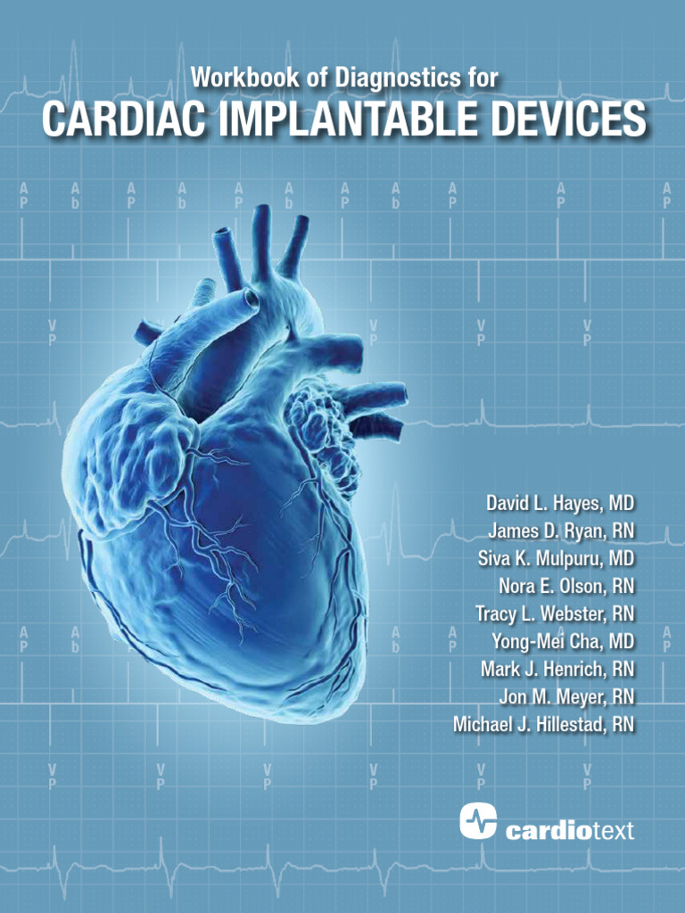 Workbook of Diagnostics for Cardiac Implantable Devices (David L. Hayes ...