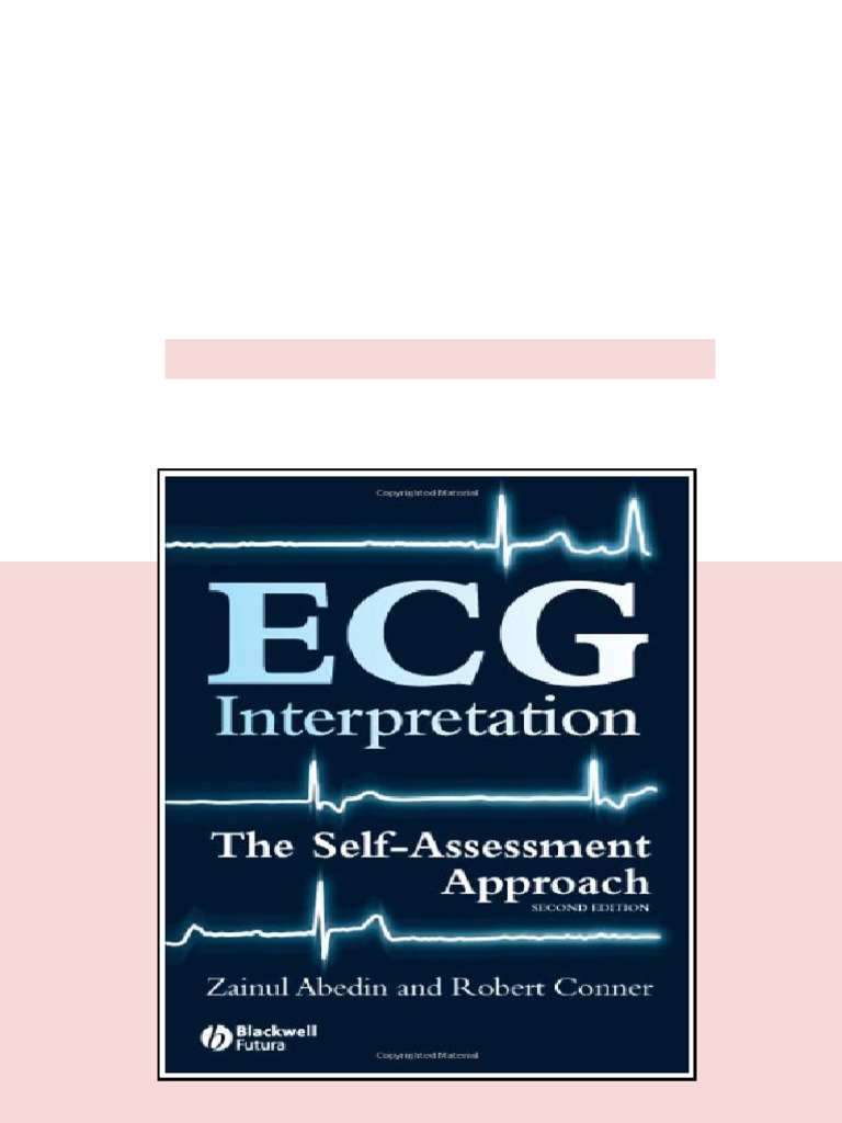(Ebook) ECG Interpretation: The Self-Assessment Approach by Zainul ...