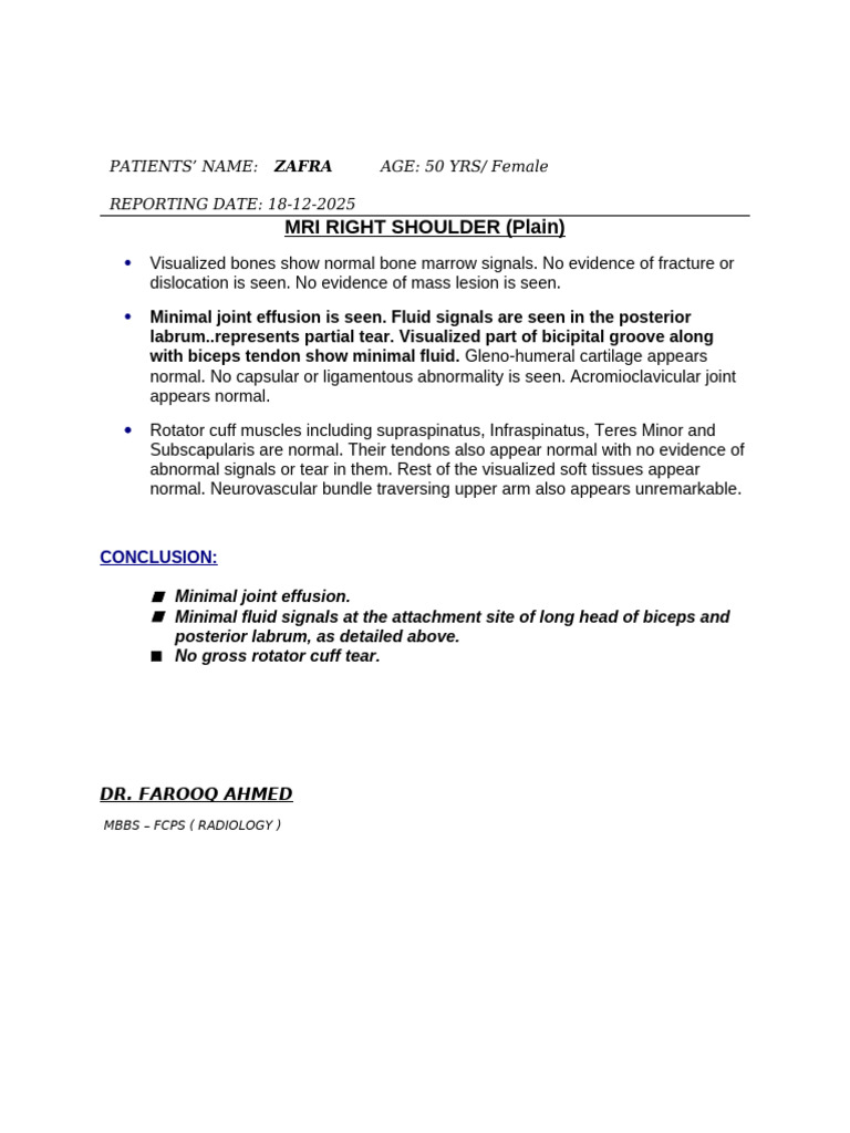 Mri Shoulder Joint Effusion Labral Tear Zafra Bb | PDF