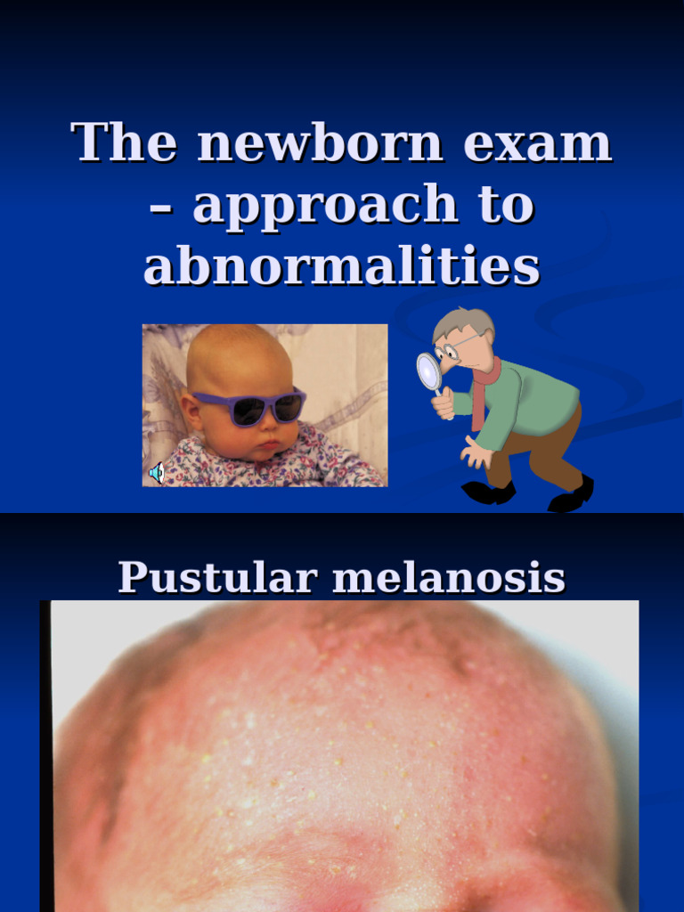 Newborn Exam: Identifying Abnormalities | PDF
