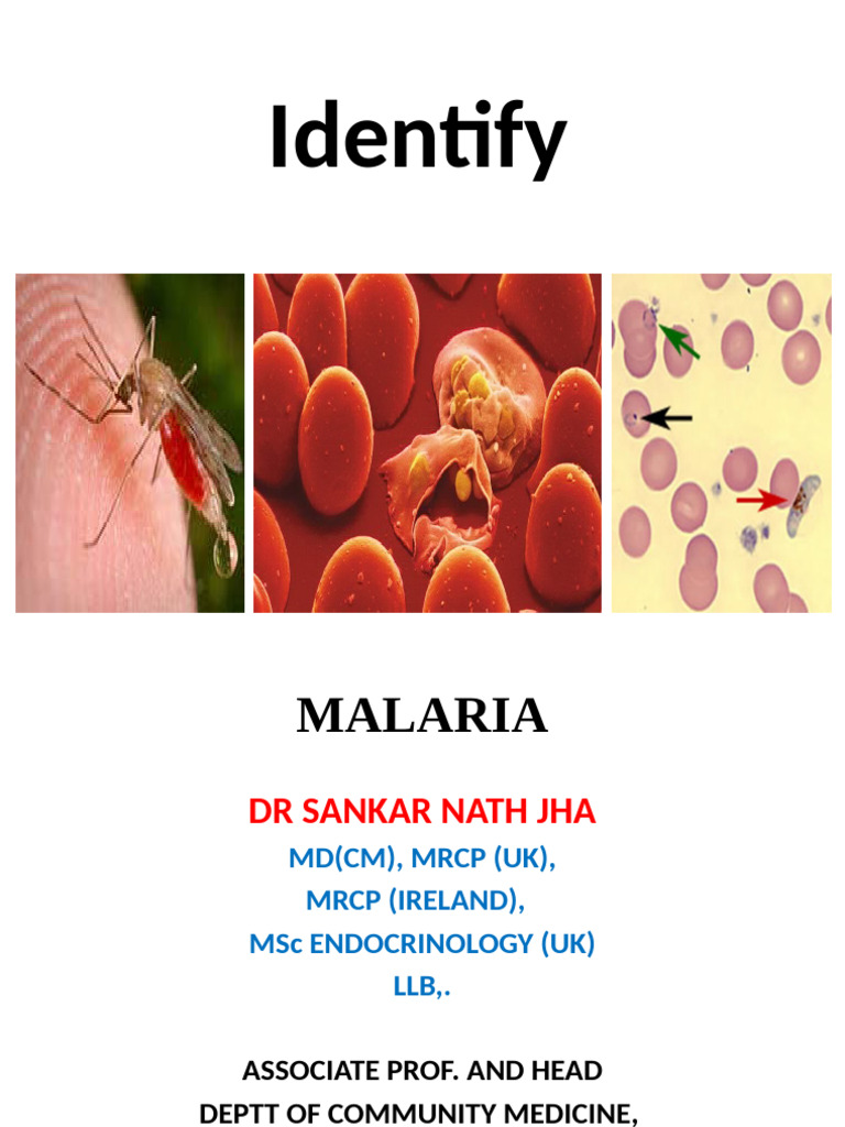 Understanding Malaria: Causes and Impact | PDF | Malaria | Plasmodium ...