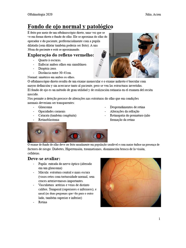 Exame de Fundo de Olho em Oftalmologia | PDF | Olho humano | Glaucoma