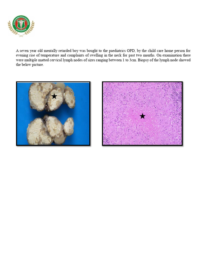 Pathology Exam Cases and Diagnoses | PDF | Necrosis | Pathology