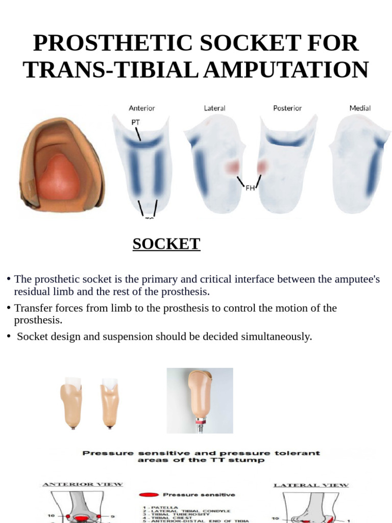 Prosthetic Socket For Trans-Tibial Amputation | PDF | Prosthesis ...