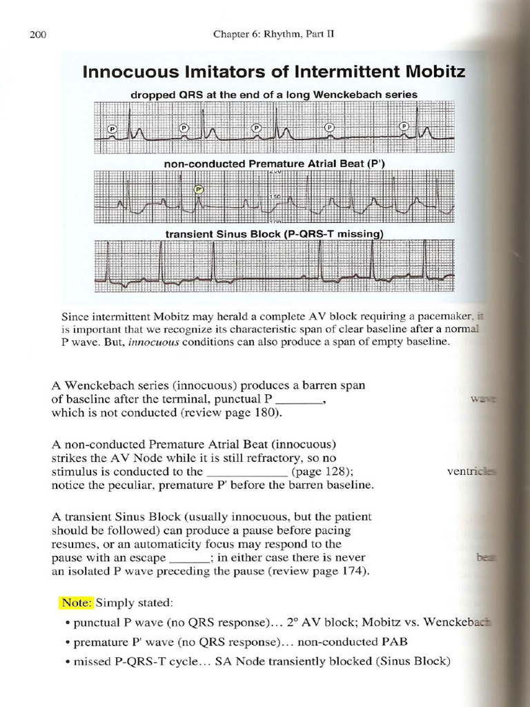 Dale Dubin - Rapid Interpretation of EKGs 6th Ed 203-316 | PDF