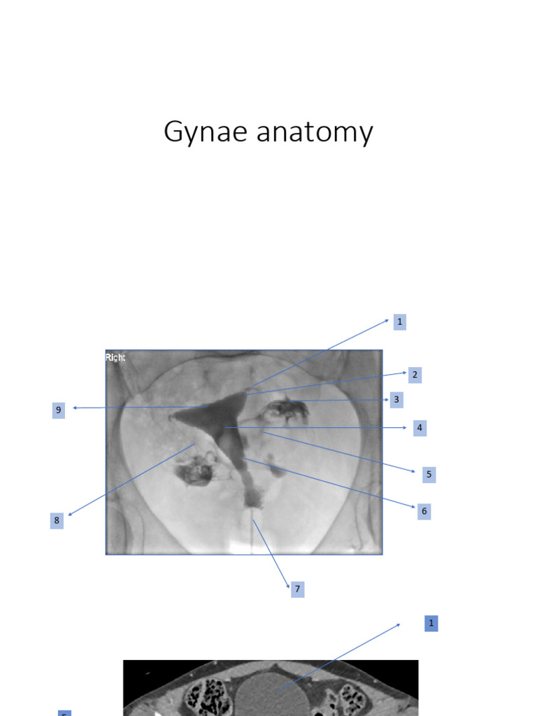 Gynae Anatomy | PDF