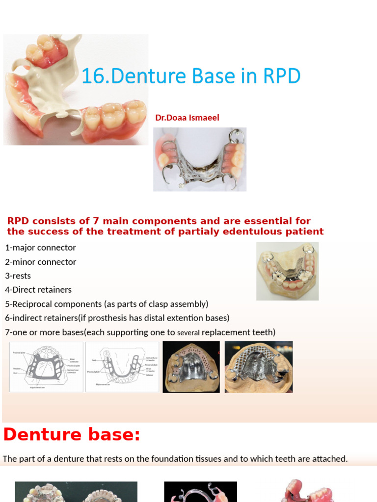 16.denture Base | PDF | Dentures | Tooth