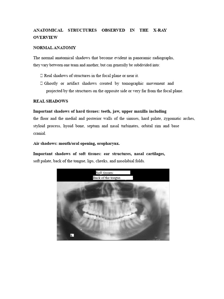 Anatomical Structures Observed in the Panoramic Radiograph | PDF ...