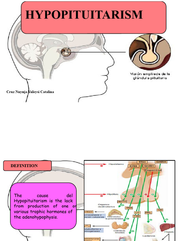 Hypopituitarism | PDF | Diseases And Disorders | Medical Specialties