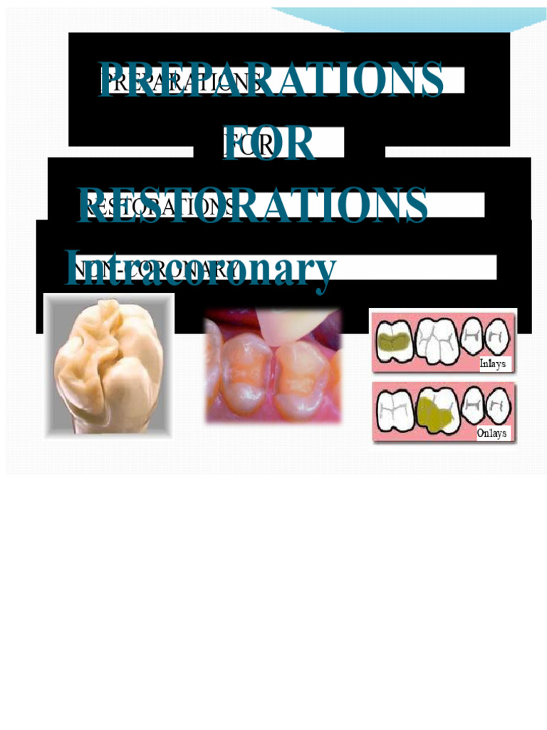 Inlay - Onlay restorations | PDF | Tooth | Dental Anatomy