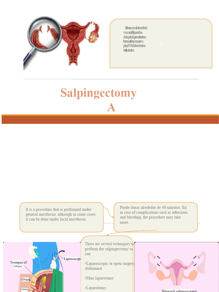 Salpingectomy | PDF | Reproductive System | Female Mammals