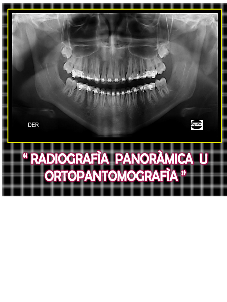 Panoramic Radiography Techniques Guide | PDF
