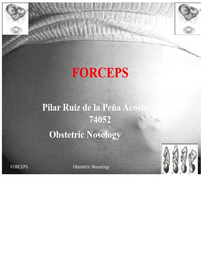 FORCEPS | PDF | Childbirth | Maternal Health