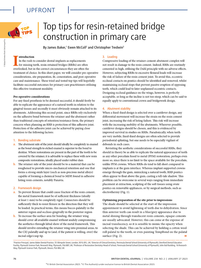 Essential Tips for Resin-Retained Bridges | PDF | Dental Implant ...