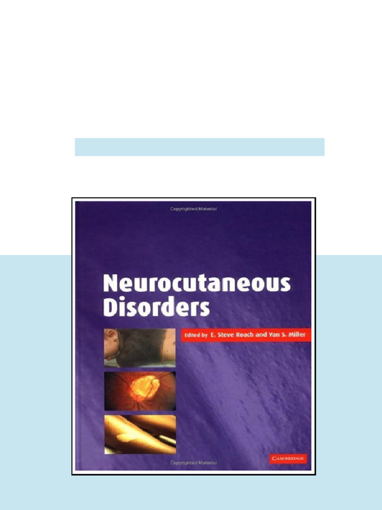 (Ebook) Neurocutaneous Disorders by E. Steve Roach, Van S. Miller ISBN ...