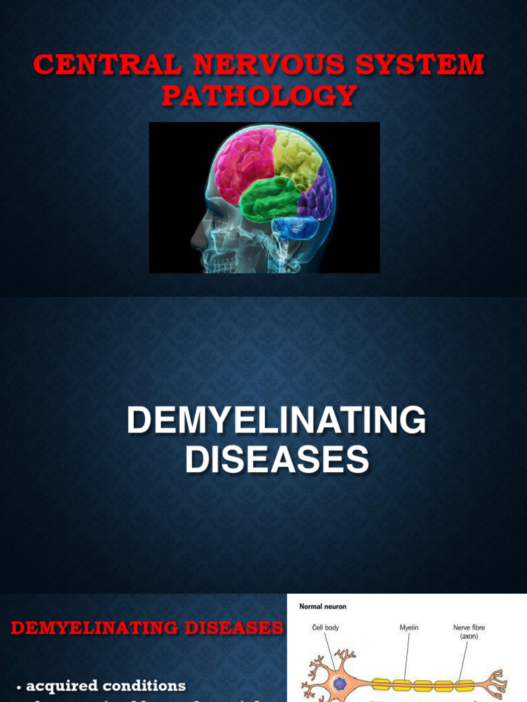 Central Nervous System Pathology Lecture - Compressed | PDF | Parkinson ...
