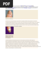 Guía sobre Cromoniquia y Alteraciones Ungueales | PDF | Clavo (anatomía ...