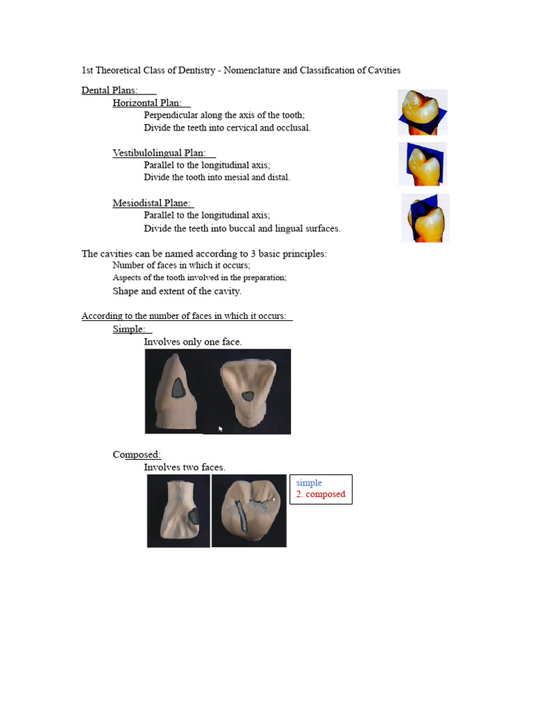Theoretical Class 01 – Nomenclature and Classification of Cavities ...