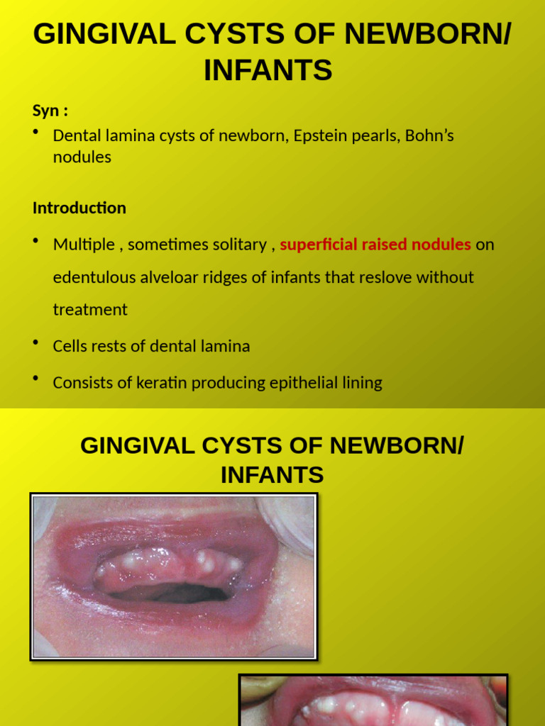 cysts 2 | PDF | Medical Specialties | Anatomy