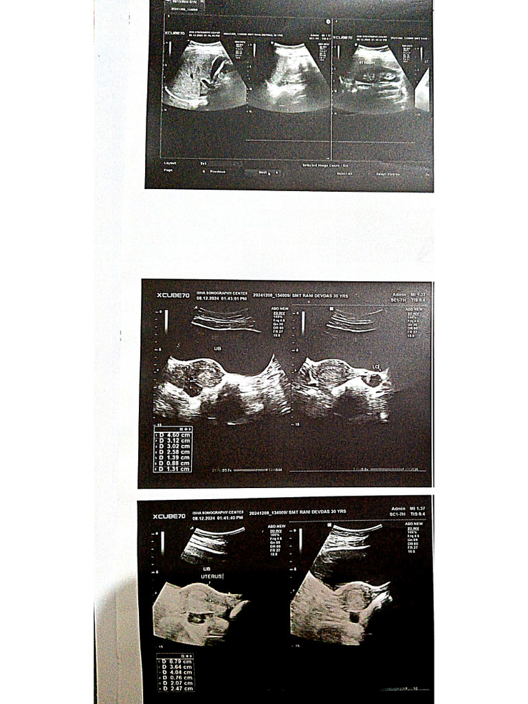 Rani Sonography | PDF