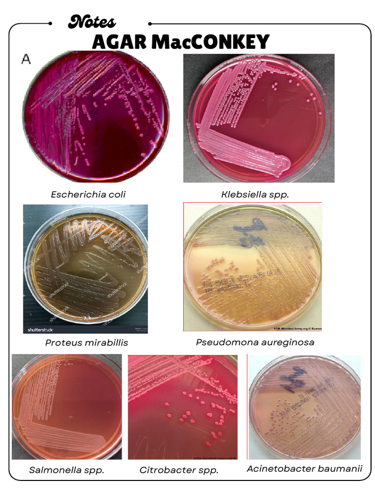 AGAR MCK | PDF