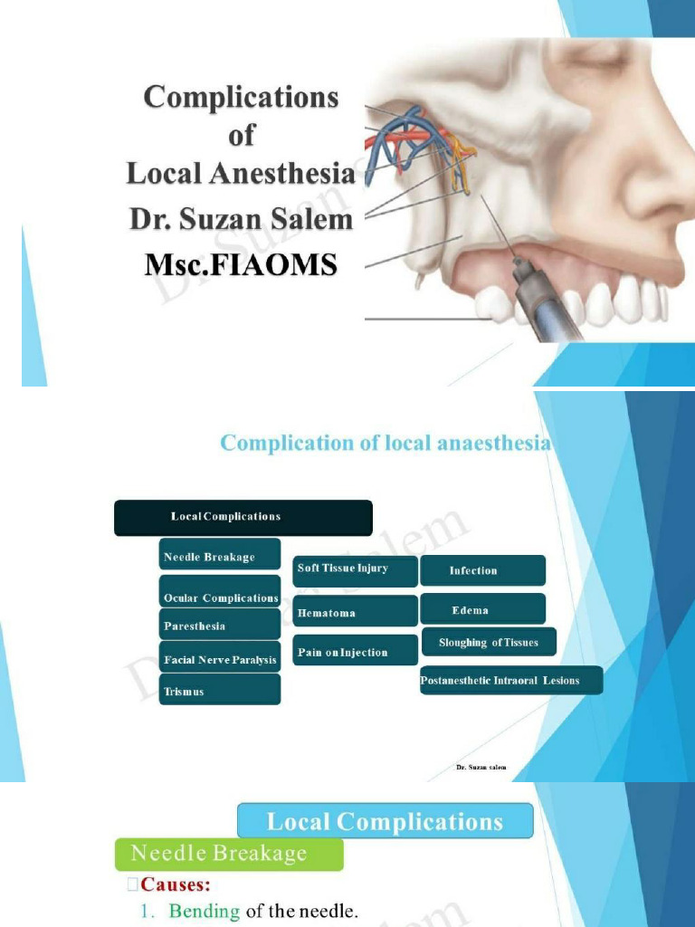 14) Complication of Local Anesthesia Dr Suzan Salem.pptx | PDF