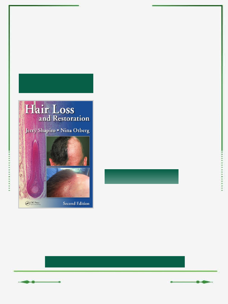 Hair Loss and Restoration 2nd Edition Otberg ebook updated file version ...