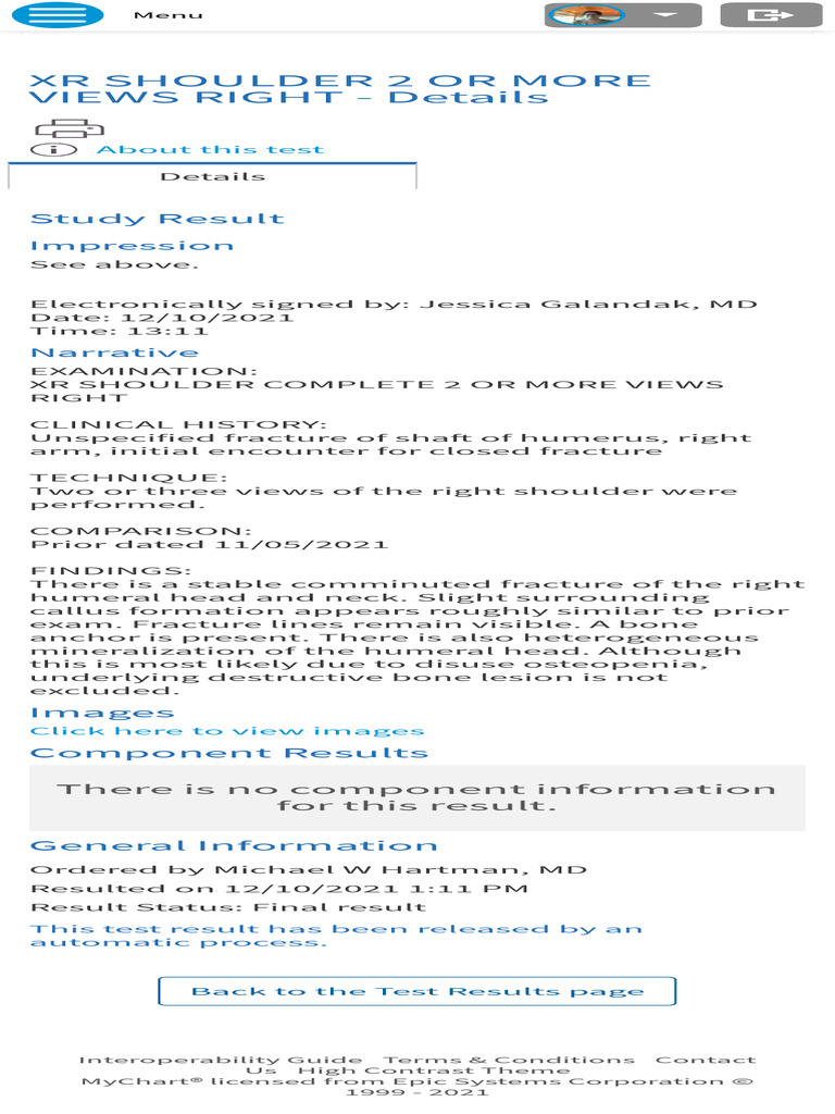 MyOchsner - Test Details | PDF