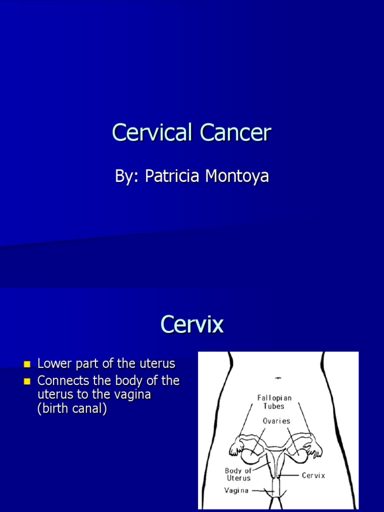 Cervical Cancer | PDF | Cervical Cancer | Neoplasms