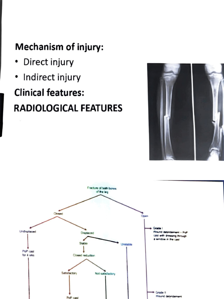 Injury To Leg, Ankle, Foot | PDF