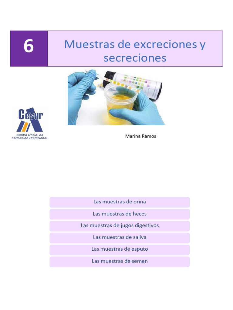 Tema 6 - Muestras de Excreciones y Secreciones (GestiÃ N Muestras BiolÃ ...