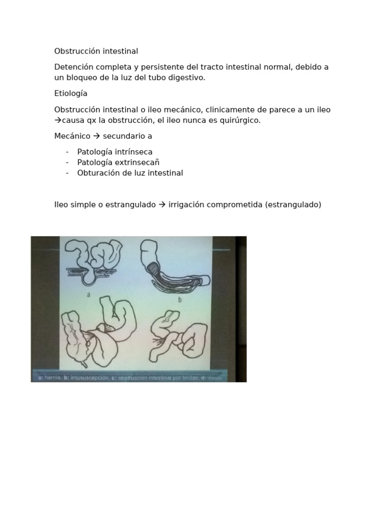 Obstrucción Intestinal | PDF