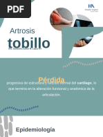 Proceso de Stieda y su tratamiento | PDF | Tobillo | Cirugía