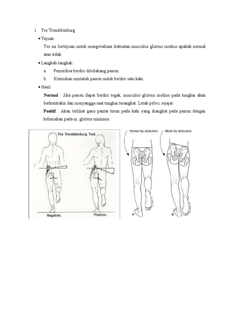 Tes Trendelenburg | PDF