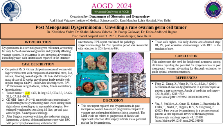 Post Menopausal Dysgerminoma : Unveiling a rare ovarian germ cell tumor ...