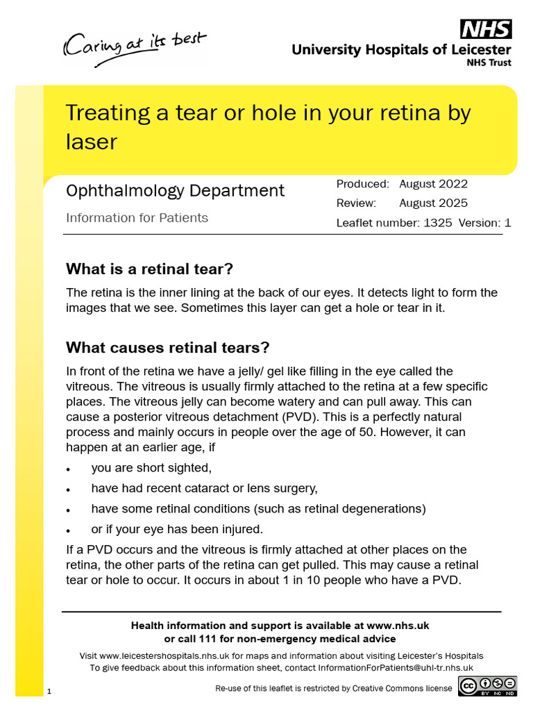 1325 - 082022 Treating A Tear or Hole in Your Retina by Laser | PDF ...
