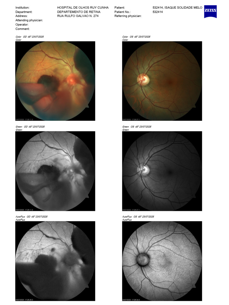 Retina Examination Report for Isaque Melo | PDF