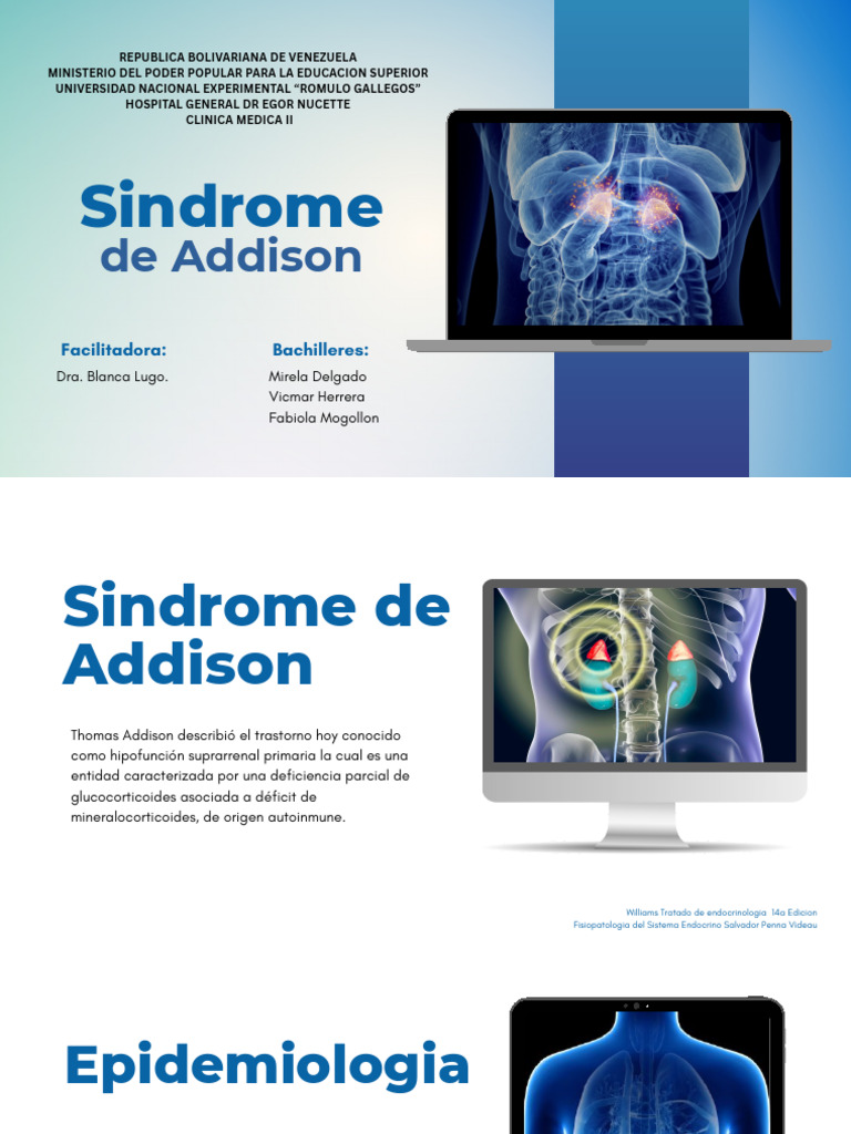 Sindrome de Addison | PDF | Glucocorticoides | Endocrinología