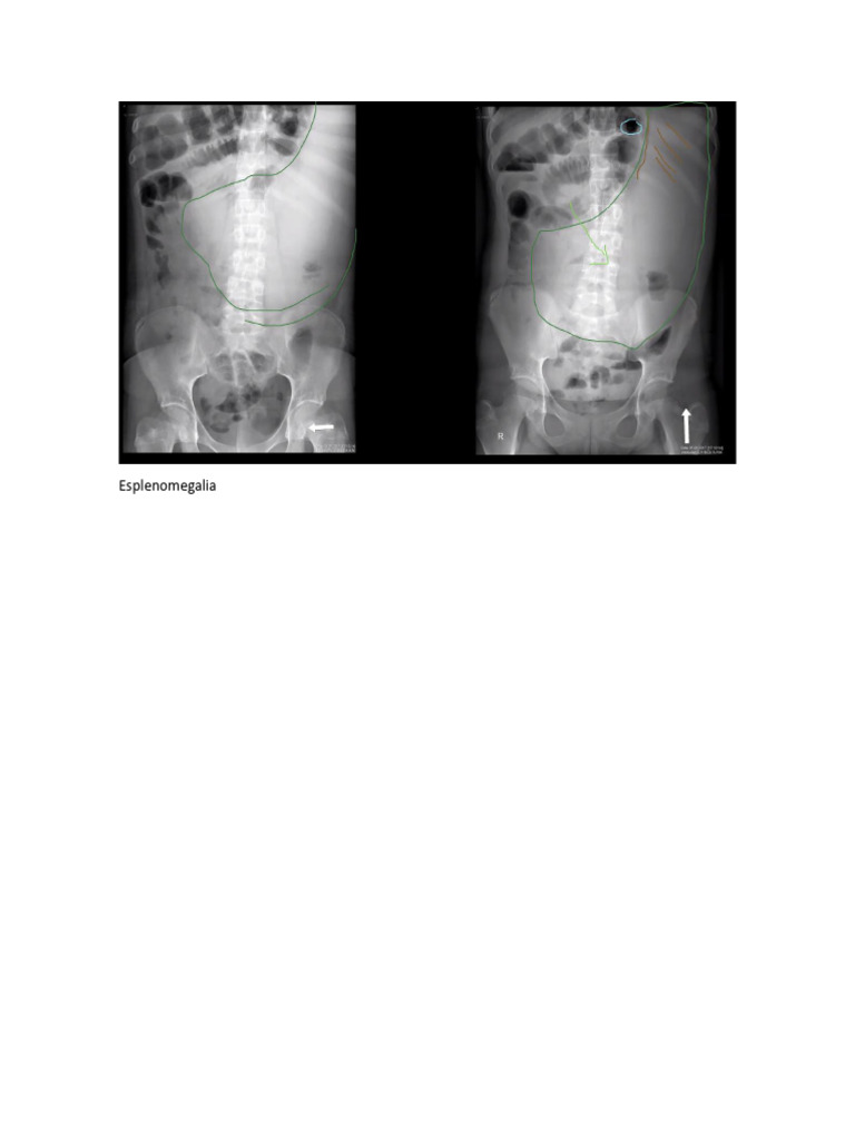 Radiología rotation virtual | PDF | Abdomen | Rodilla