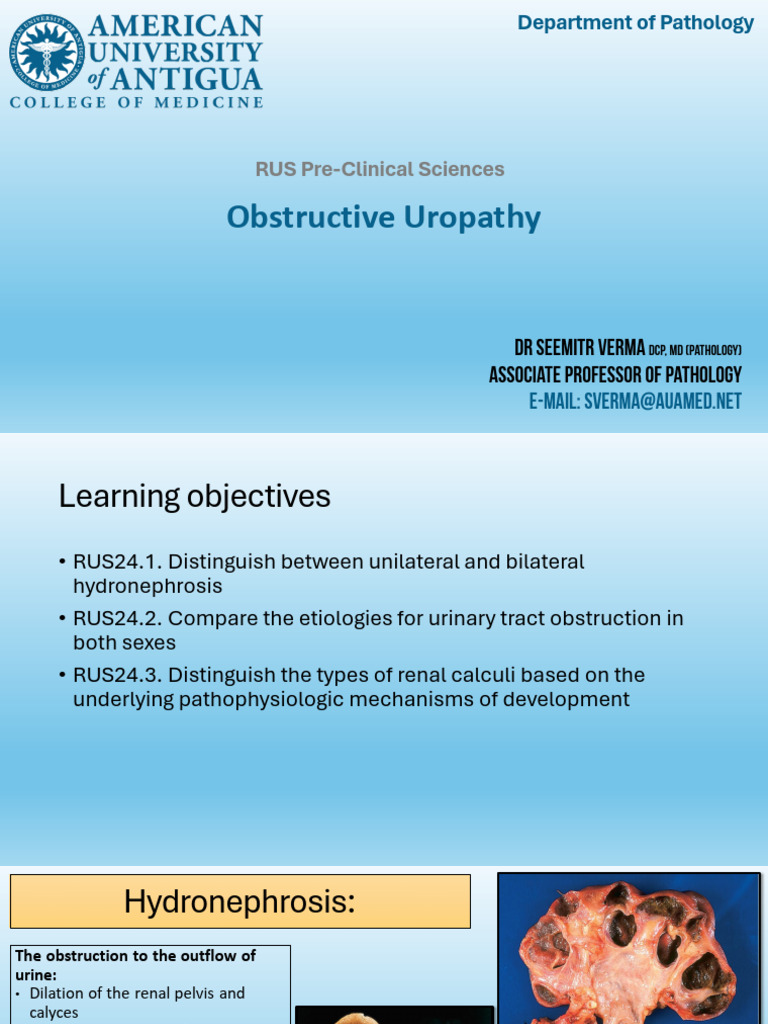 Obstructive Uropathy and Hydronephrosis Guide | PDF | Kidney | Urology
