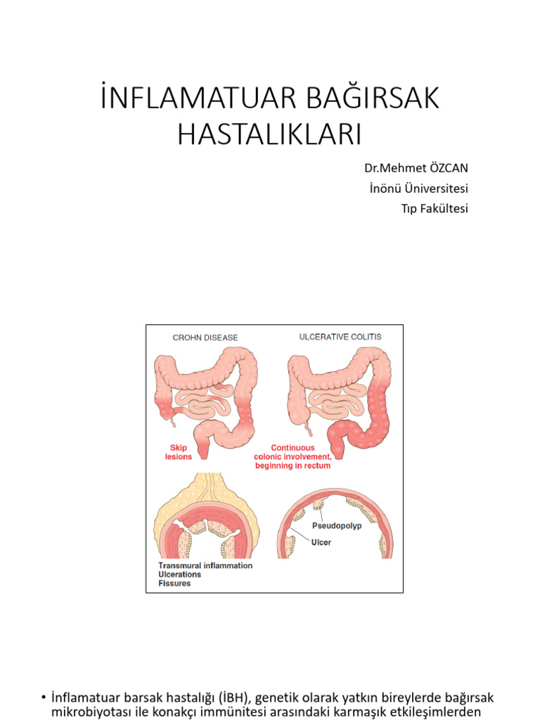 12 İnflamatuar Barsak Hastalıkları Patolojisi | PDF