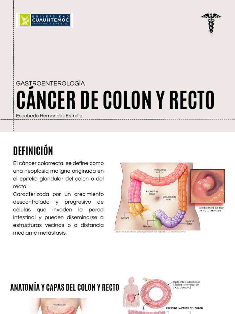 Cáncer de colon y recto .pdf | PDF | Cáncer colonrectal | Cáncer